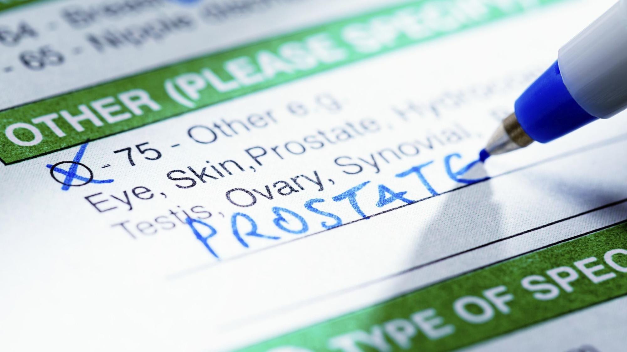 Prostate Cancer Screening & Treatment | Adult Pediatric Urology