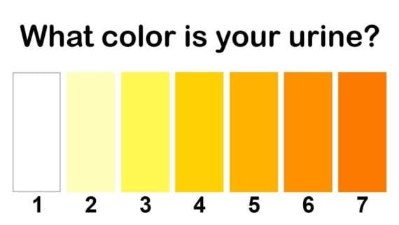 Urine Color Meaning & Urine Color Chart